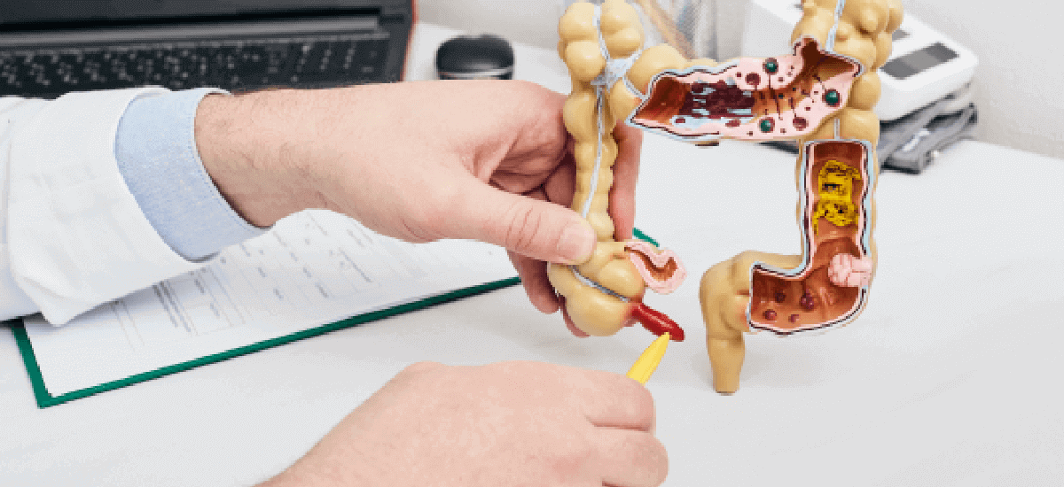 Appendicitis: Symptoms, Causes, Prevention and Treatments