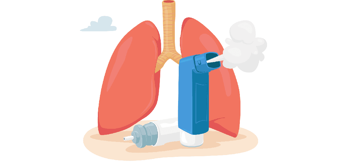 Asthma: Symptoms, Causes, Prevention and Treatments