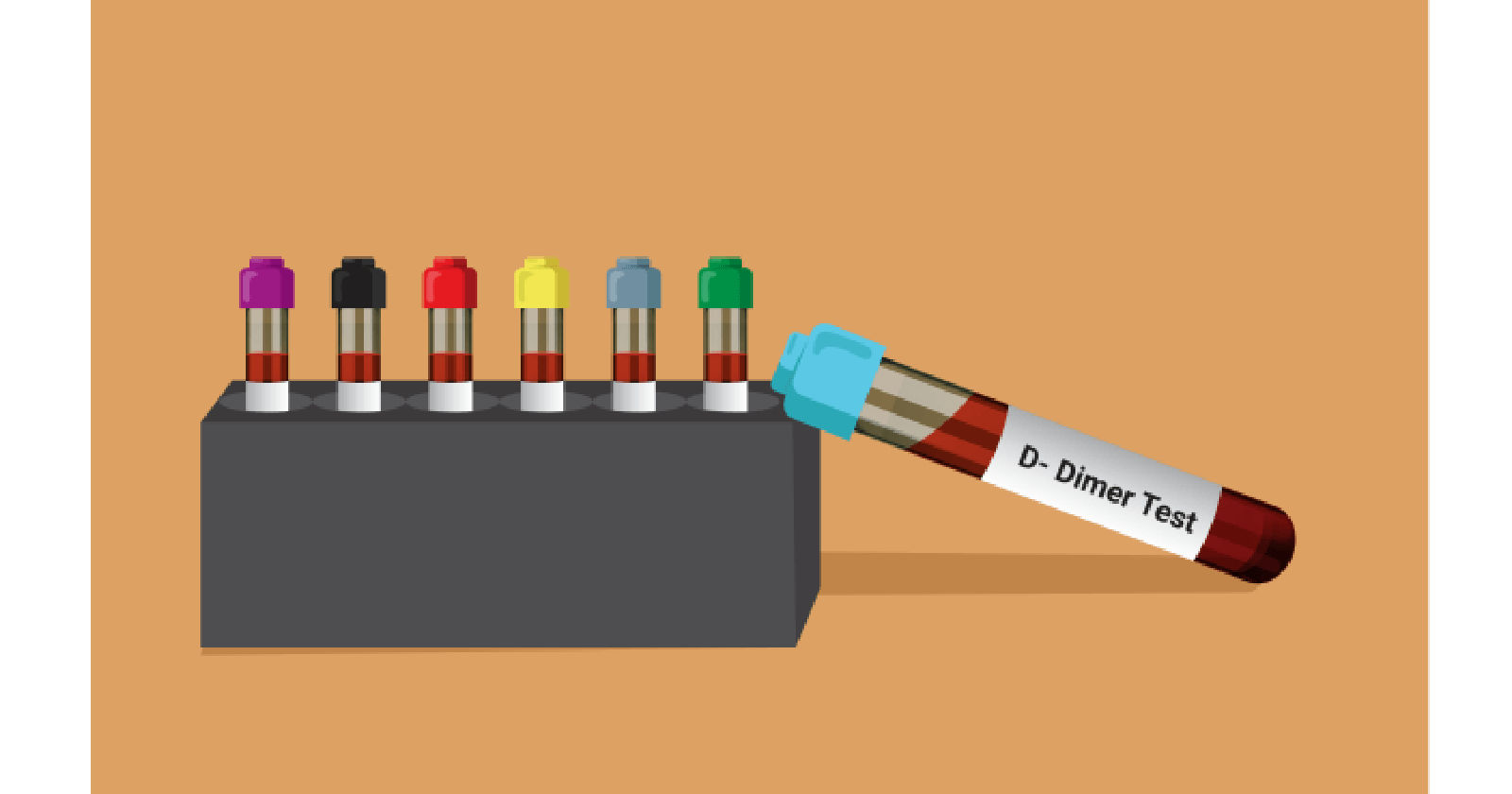 Overview Of The D-dimer Test: Uses, Preparation And Risks