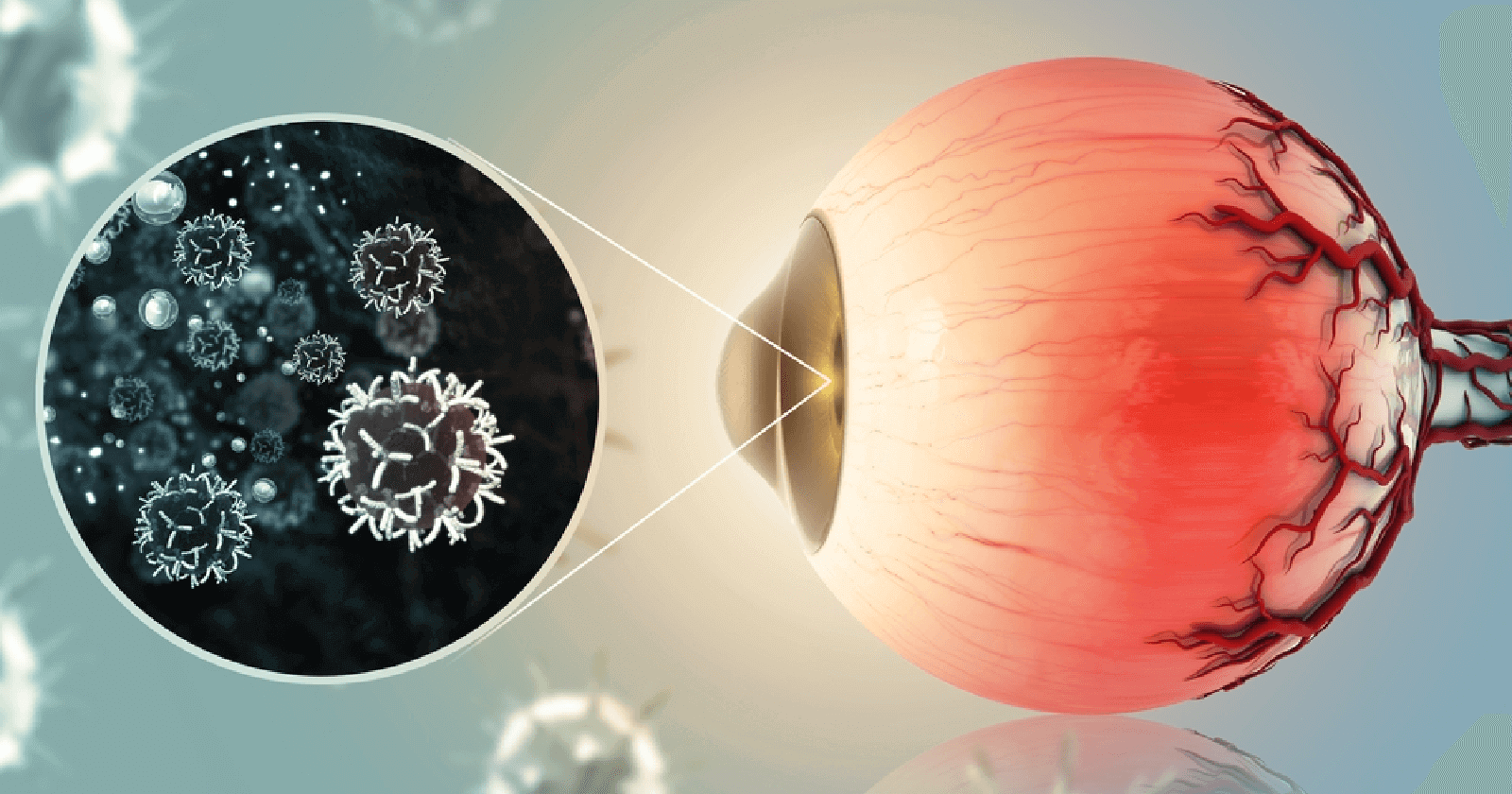 Eye Cancer: Types, Symptoms, Causes, Prevention and Treatments