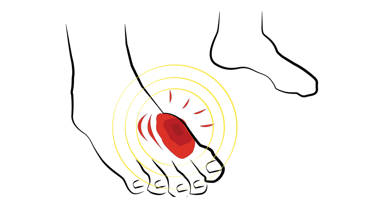 First Aid for Puncture Wounds - Types, Signs & Quick Action